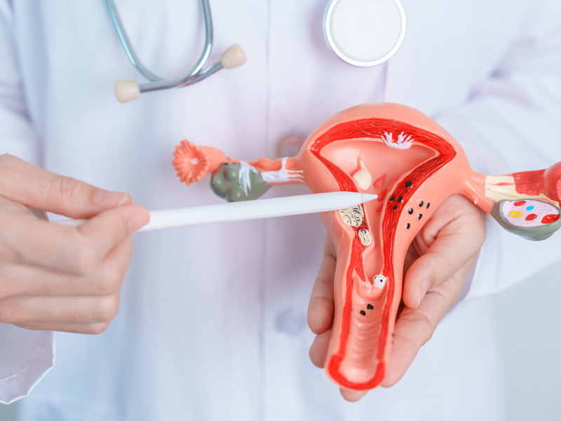 Hormone Therapy After Hysterectomy: What to Consider - Nava Health